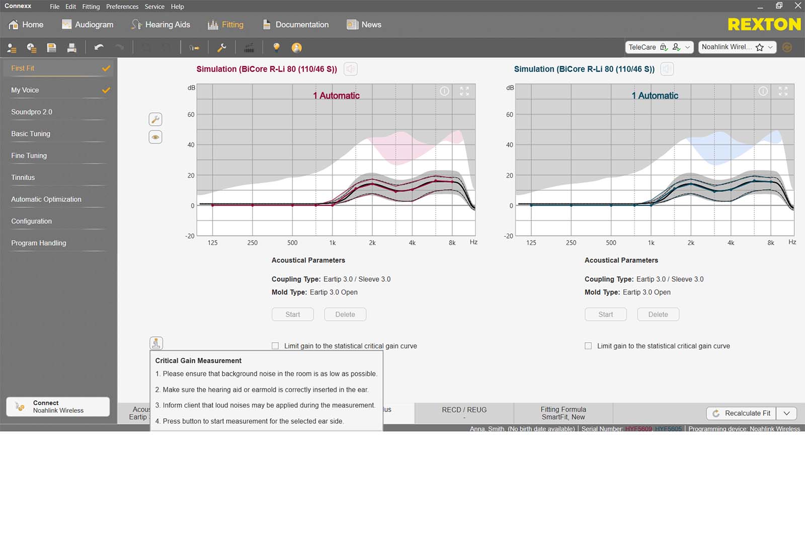 Connexx - fitting software for Rexton hearing aids | Rexton